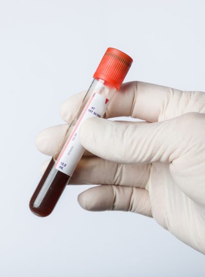 Hematologia, czyli choroby krwi – co to jest? Rodzaje, objawy, badania ...