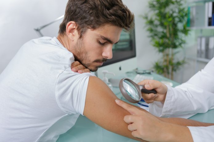 Liszaj lśniący – przyczyny, objawy, leczenie - Poradnik Apteki Gemini